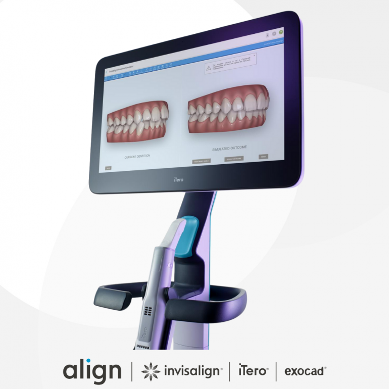 Itero, el escaner 3D de Invisalign - Denta Care