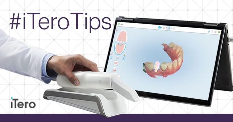 ITero Element Flex ahora al servicio de los odontólogos en USA - Denta Care