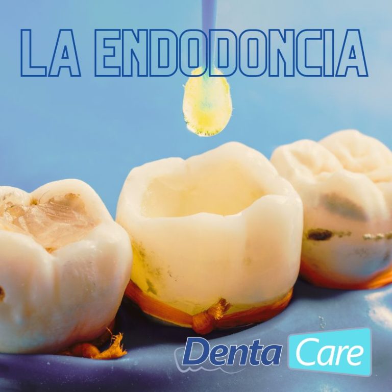 La endodoncia: salvando dientes y preservando sonrisas en DentaCare ...