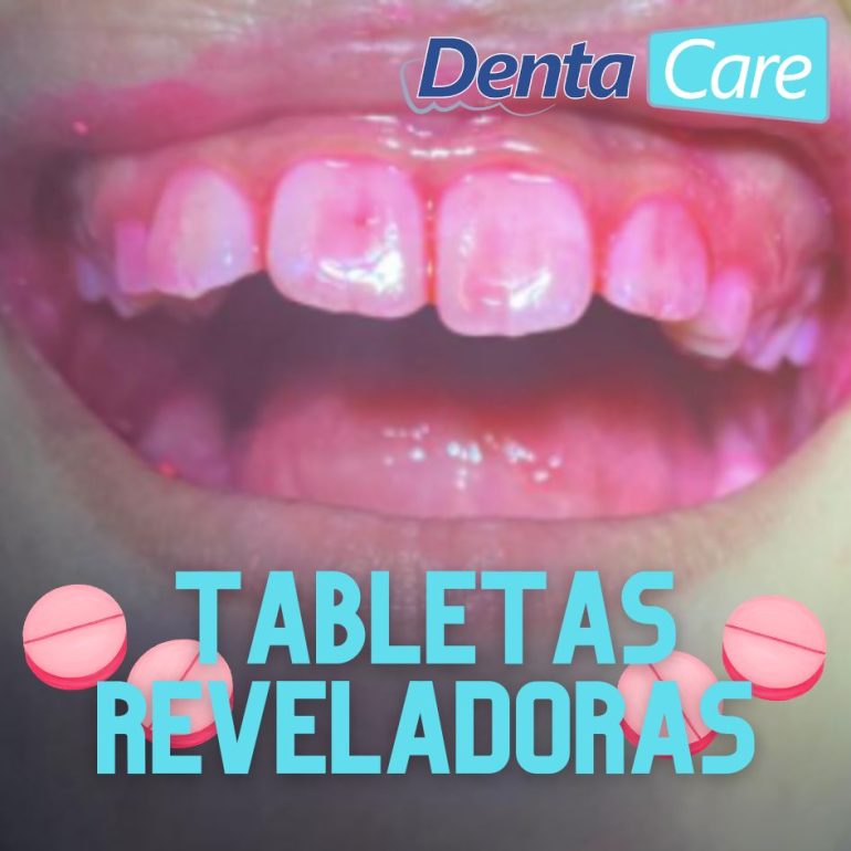 Mejora tu Rutina de Cuidado Dental: Descubre las Tabletas Reveladoras ...
