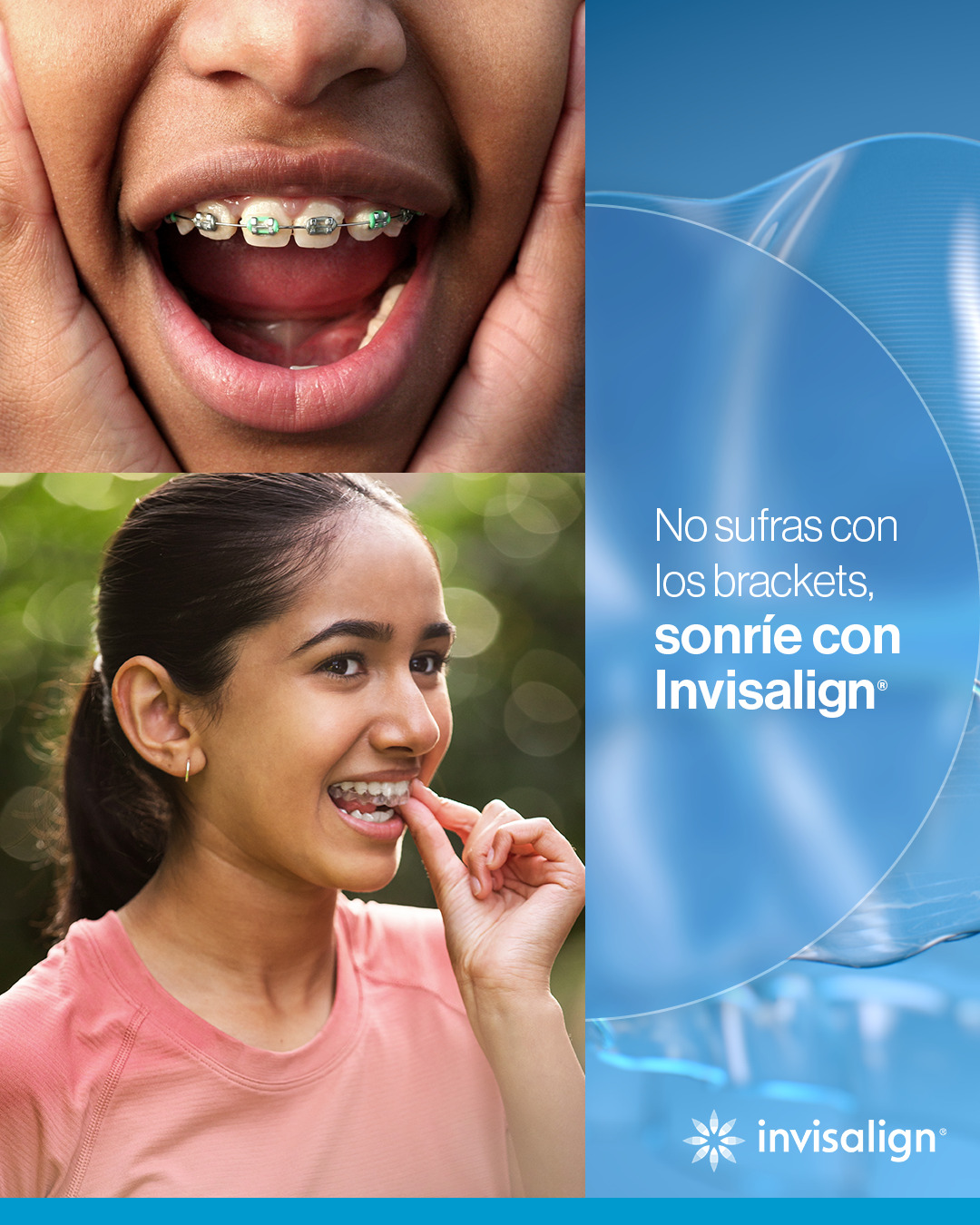 Invisalign para Adolescentes - Denta Care