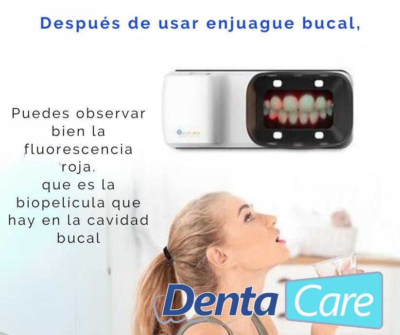 Qscan Plus, Visualiza el Estado de Tus Dientes en Tiempo Real - Denta Care