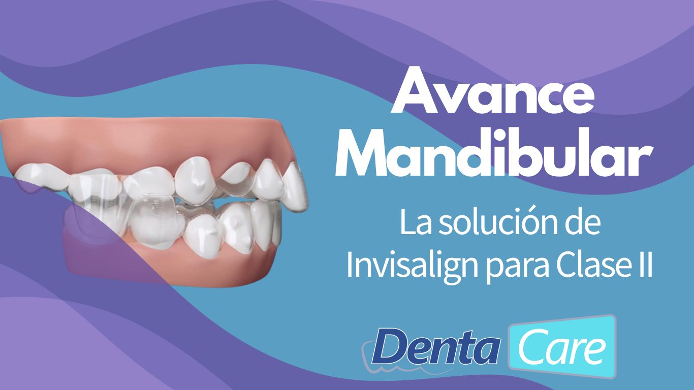 Avance Mandibular de Invisalign - Denta Care
