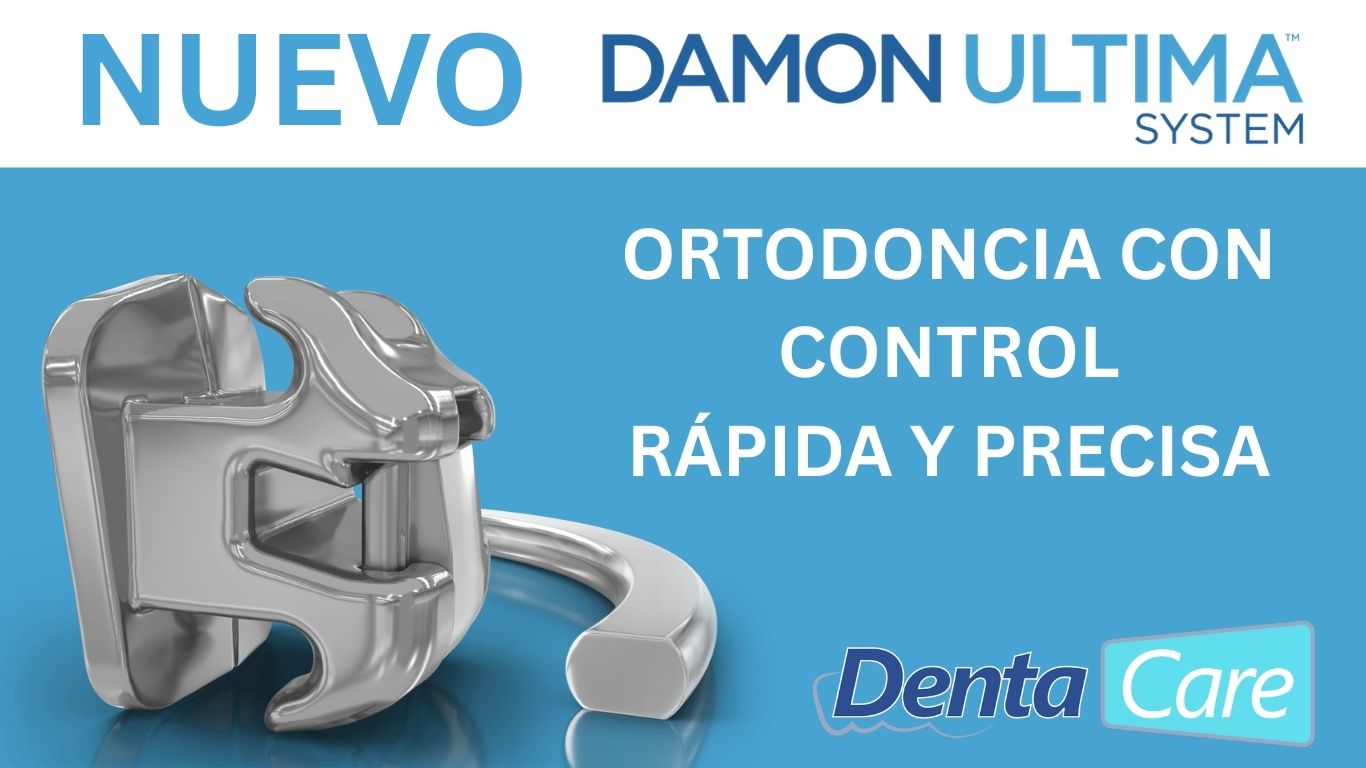 Damon Ultima: La Ortodoncia de Autoligado Completa ¡Ya en México ...